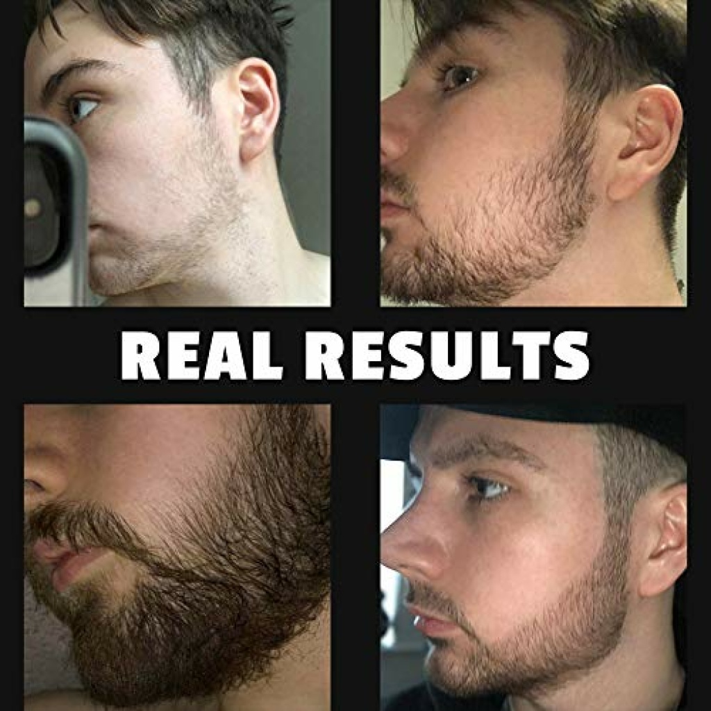 Red-Blooded Beard Growth Roller | Stimulate Beard and Hair Growth | 540 ...